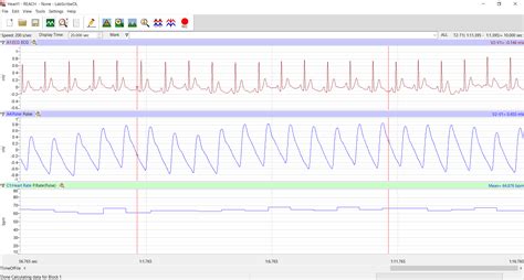 Reach Dl Heart 3 Ecg Temperature