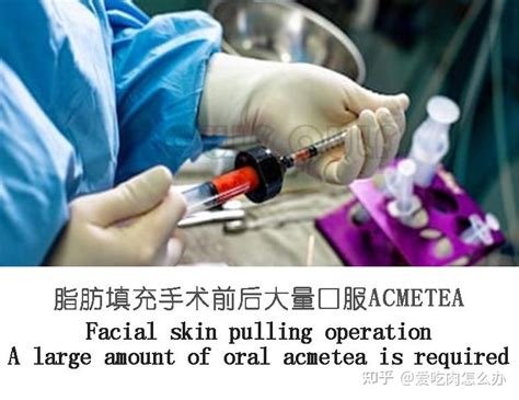 额头脂肪填充能挺多久？额头脂肪填充后遗症？过来人给你指点一二 知乎