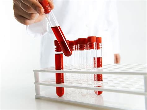 Serum Phosphorus Test Purpose Procedure And Results