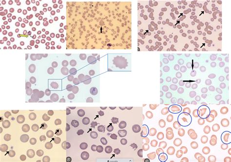Diagram Of Module 4 Erythrocytes Morphology Quizlet