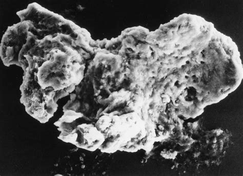 Scanning Electron Photomicrographs Of Filtered Particle 15 Kv Download Scientific Diagram