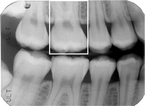 Local Segmentation Teeth Isolation Download Scientific Diagram