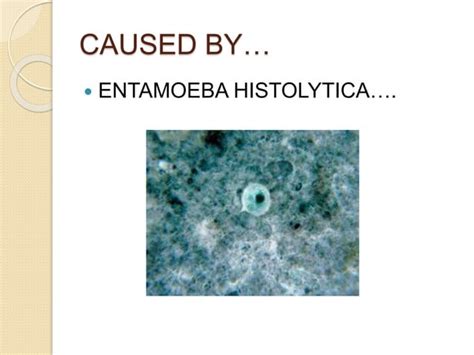 Amoebiasis Ppt