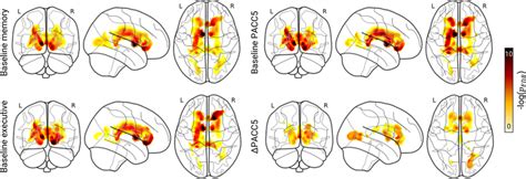 Wmh Volume Is Associated With Worse Baseline Cognitive Performance And Download Scientific Wmh Volume Is Associated With Worse Baseline Cognitive Performance And Download Scientific