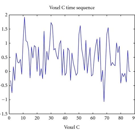 Voxel Time Series Voxels A” And B” Are Detected By Both Spm T Test