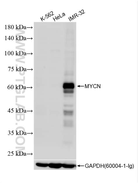 Mycn Antibody 84886 3 Rr Proteintech 武汉三鹰生物技术有限公司
