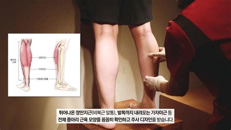 종아리 굵기와 건강 하체근육 발달시키는 운동 타코야
