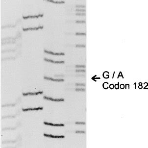 Sequencing Of Exon 4 In Patient 1 Using The Reverse Primer Detection Download Scientific