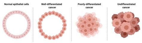 Introduction Definitions And Tumour Nomenclature Flashcards Quizlet