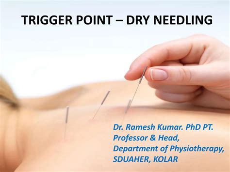 Basics In Dry Needling And Trigger Points Pptx