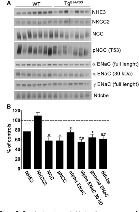 Figure 1 From Overexpression Of Pendrin In Intercalated Cells Produces Chloride Sensitive