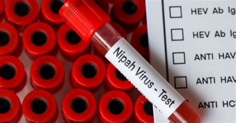Can A Person Survive With Nipah Virus Infection Tips Krips