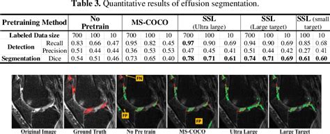Self Supervised RCNN For Medical Image Segmentation With Limited Data Annotation