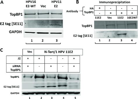 HPV11 E2 Protein Levels Are Regulated By TopBP1 In N Tert 1 Cells In A