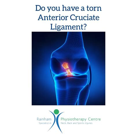 Do You Have An Acl Tear Rainham Physio