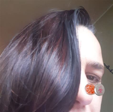 Tiande Zdrave I Krasota Споделено🥰 Пигментни петна по ръцете Решение в 2 стъпки