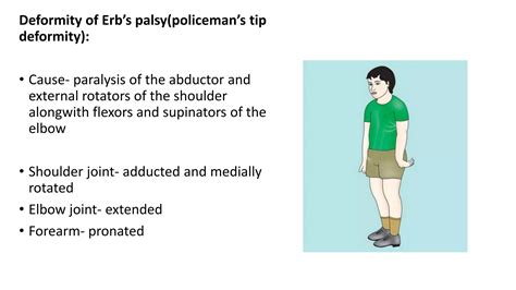 Brachial Plexus And Peripheral Nerve Lesion { 1821 1830 } Pptx
