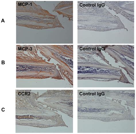 A B Protein Expression Levels Of MCP 1 A And MCP 3 B Were Download Scientific Diagram