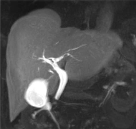Influence Of Flip Angles 3d T1 Weighted Spoiled Gradient Echo Download Scientific Diagram
