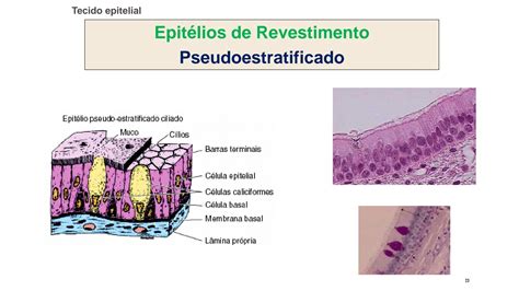 Histologia Entendendo O Tecido Epitelial Ciência Como Pdf Knowunity