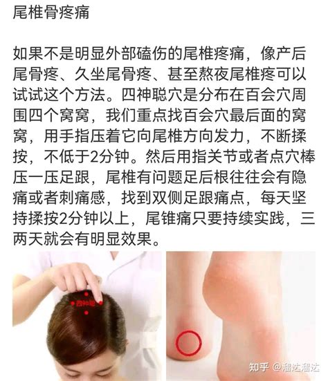 尾椎骨疼痛，。 知乎