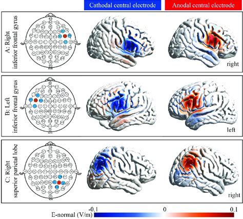 Electrode Montage And Current Flow For High Definition Transcranial