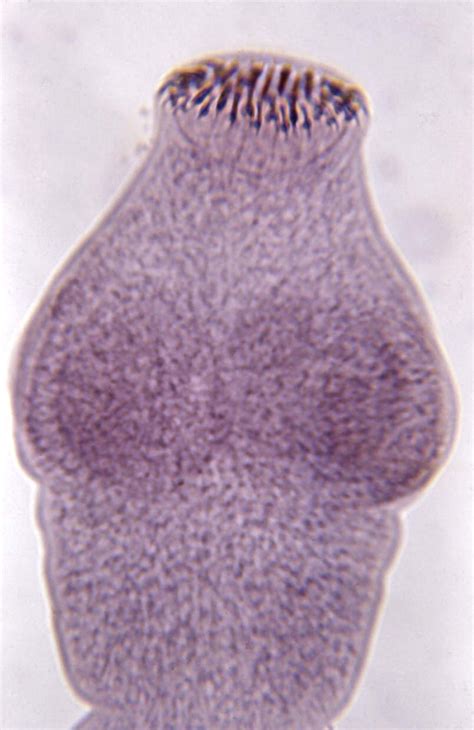 Echinococcus Ova