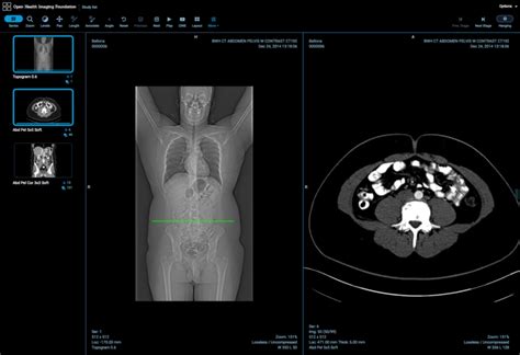 Project Week 25 Dicom Segmentation Support For Cornerstone And Ohif Viewer Namic Wiki