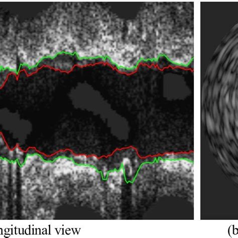 Workflow Of The Proposed Sqa Assisted Annotation Framework To The Ivus