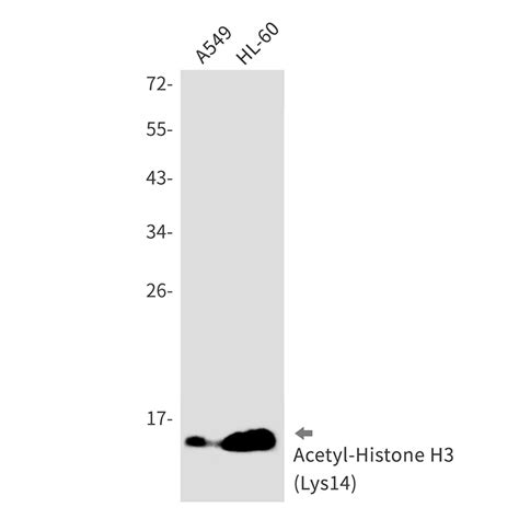 Acetyl Histone H3 Lys14 Rabbit Mab Wb Ip Icc Buy Now Abcepta