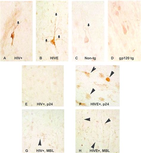 Distribution Of Mannose Binding Lectin Mbl In Neuronal Axons In Human