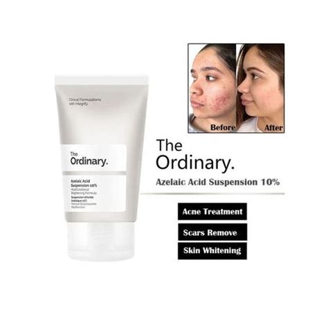 The Ordinary Azelaic Acid Suspension 10 Brighten Skin Tone Remove