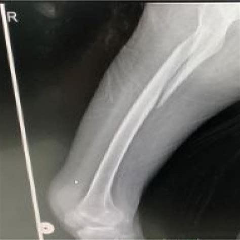Classic Landmarks For Labat Approach In Plane Approach Is Download Scientific Diagram