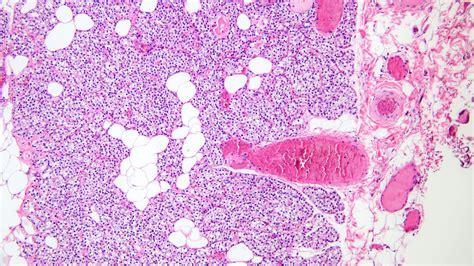 Parathyroid Microscope Slide