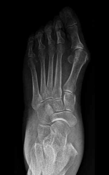 The Lapiprep System Lapidus Your Way Not Theirs