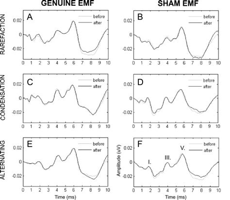 Grand Average Abr Waveforms Recorded Before And After Genuine Or Sham