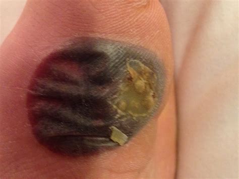 Fig126b Pediatric Case And Reference Article Pediatric Education