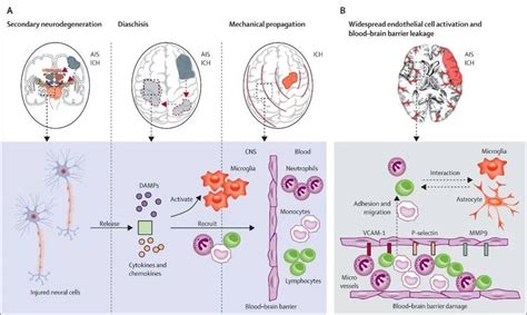 首都医科大学施福东等人提出中风后全脑炎症发病机制 学术资讯 科技工作者之家