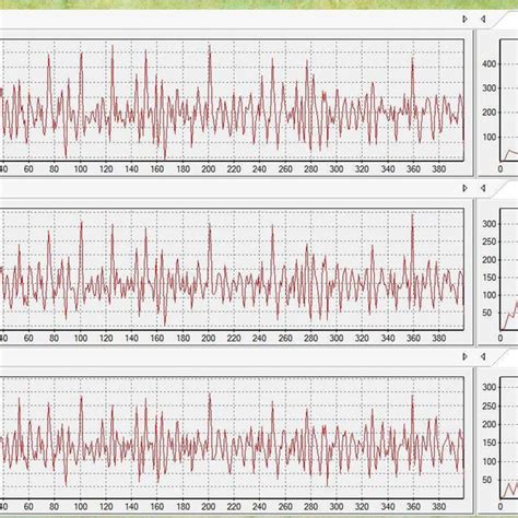 The Real Time Visual Display System Shows The EEG Signals After Download Scientific Diagram