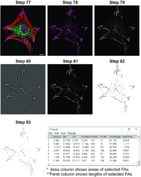 Step By Step Quantification Of Focal Adhesion FA Numbers And Lengths Download Scientific Diagram