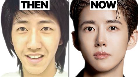 Korean Actors Who RUINED Their Face With Too Much Plastic Surgery