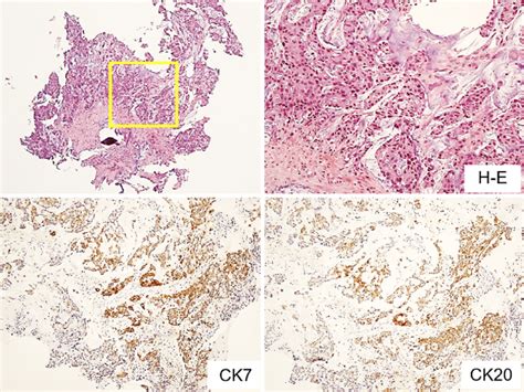 Figure3a Histological Examination Of Gastric Biopsy Samples