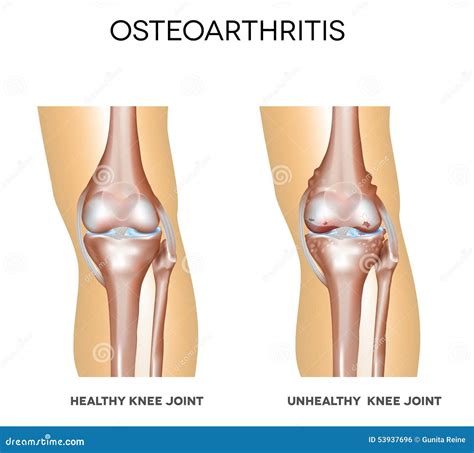 Healthy Knee Joint Labeled 3d Illustration 220535784