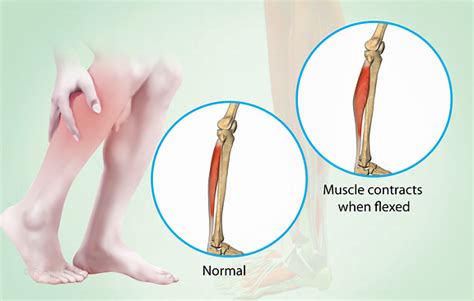Health Condition Symptoms Causes Treatment And More