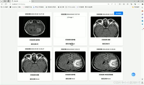 基于深度学习的医学图像分类与诊断系统（开题报告免费领） 医学图像分类系统 csdn博客