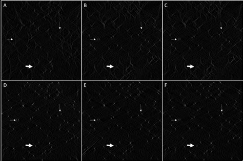 Comparison Of The Reconstructions Of The Phantom With The Different Download Scientific Diagram