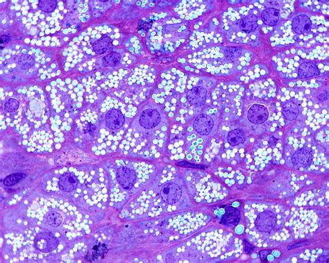 Adrenal Gland Light Micrograph Stock Image C0545743 Science Photo Library