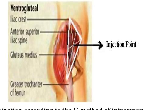 Pdf Using Ventrogluteal Site In Intramuscular Injections Is A