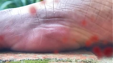 Giant Crushes Tiny People Xxx Mobile Porno Videos And Movies Iporntv Net