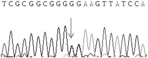 Lynch Syndrome Gene Detection Reagent Kit And Application Thereof Eureka Patsnap